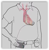 HeartWare Receives Approval From the FDA Authorizing 94 Additional ...